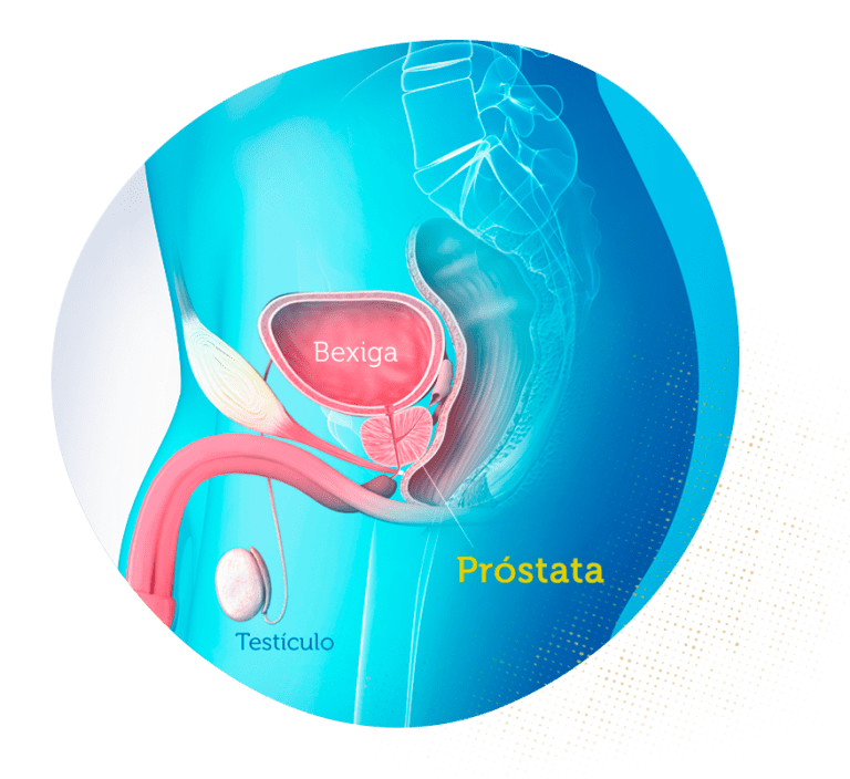 Prostatite Elo Medicina Reprodutiva